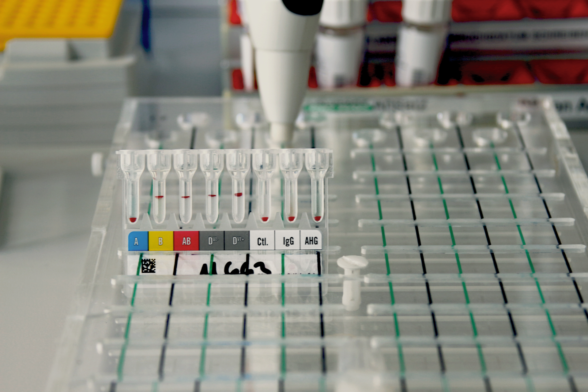 Immunhämatologie - Transfusionsmedizin