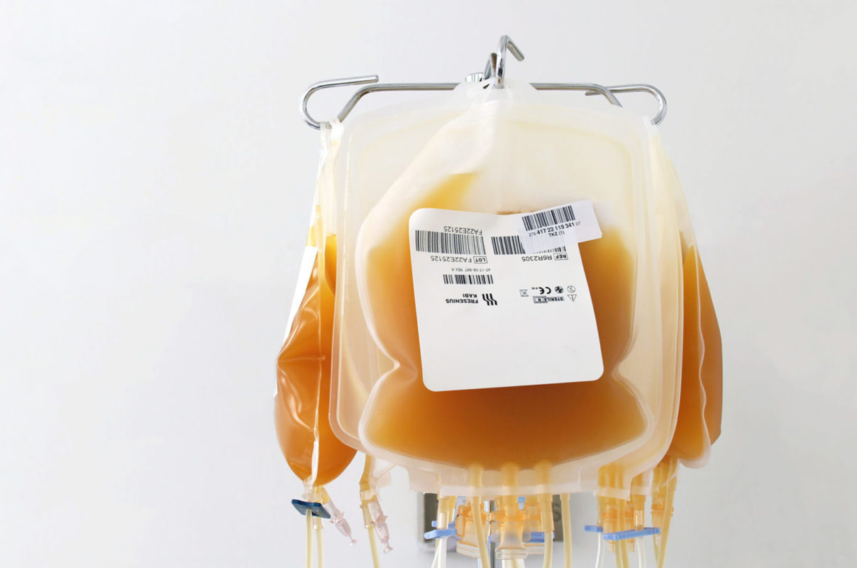 Formen der Blutspende - Transfusionsmedizin